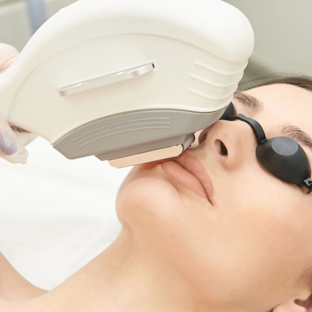 Aesthetic Lasers – M-Shape Beauty